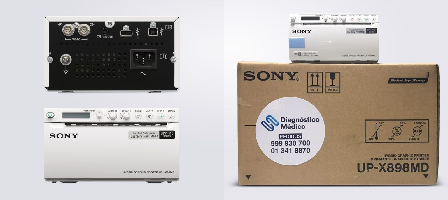 Sony Impresora UP X898MD Digital - Diagnóstico Médico SAC Perú