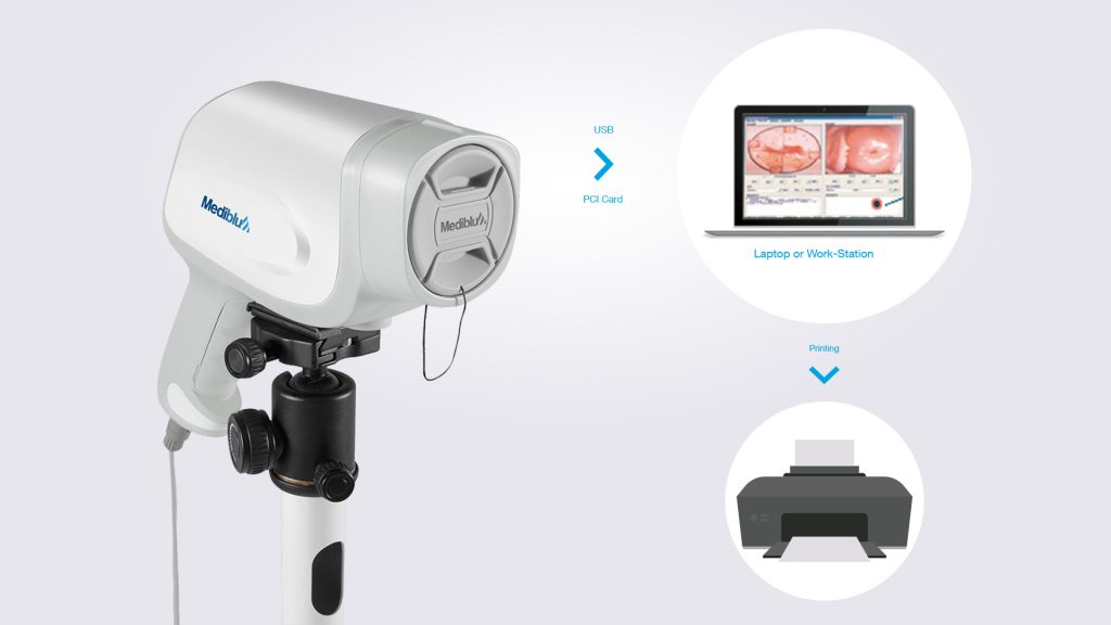 Colposcopio dvc300 - Diagnóstico Médico SAC Perú